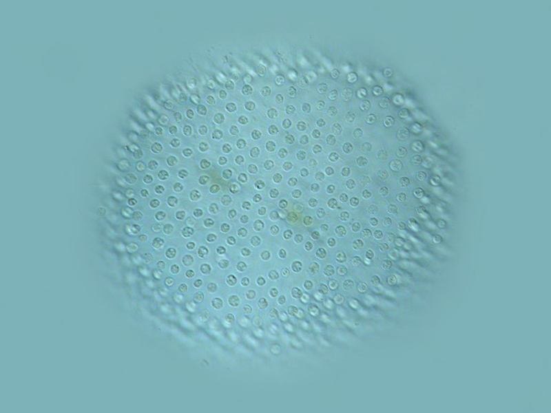 Freshwater and other micro-organisms from Germany: Sphaeroeca volvox ...