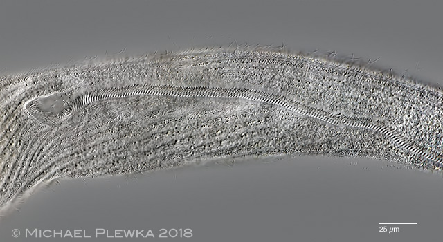 Freshwater and other micro-organisms from Germany: Spirostomum ambiguum ...