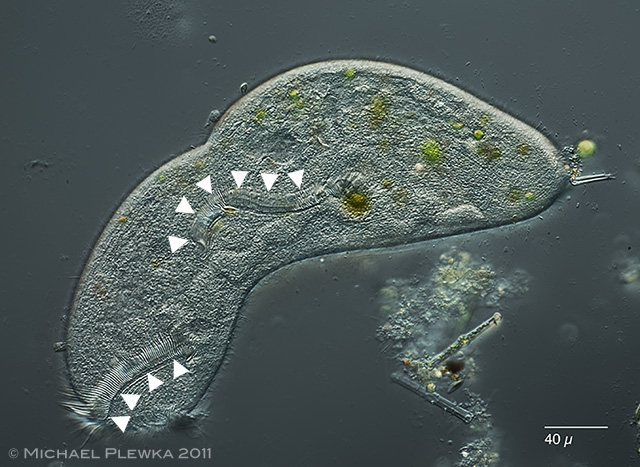 Freshwater and other micro-organisms from Germany: Stentor roeseli ...
