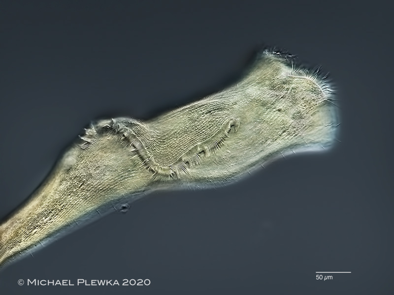 Freshwater and other micro-organisms from Germany: Stentor roeseli ...