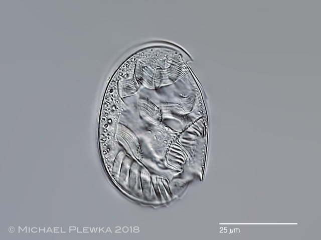 Freshwater and other micro-organisms from Germany: Aspidisca crenata ...