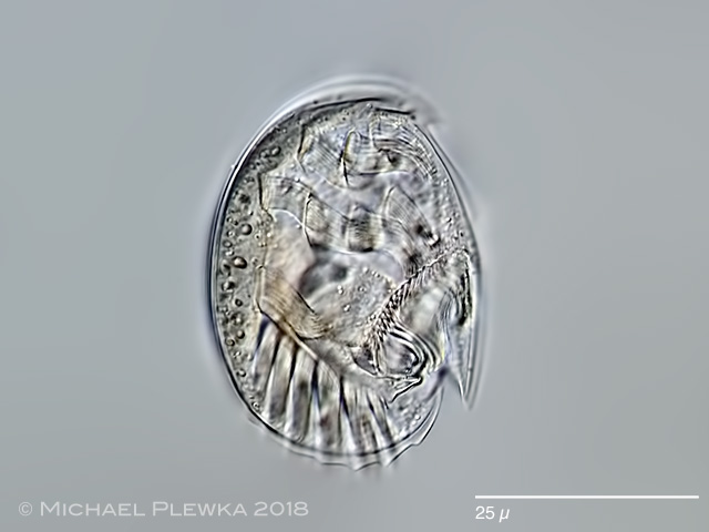 Freshwater and other micro-organisms from Germany: Aspidisca crenata ...