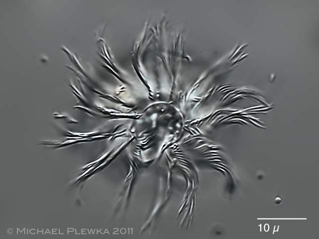 Freshwater and other micro-organisms from Germany: Halteria sp ...