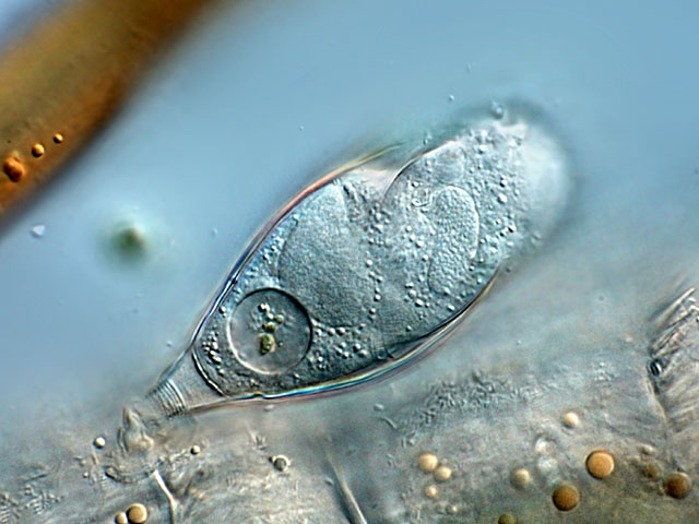 plingfactory: Leben im Teich:das Beringte Pokaltierchen (Cothurnia annulata (Ciliata)