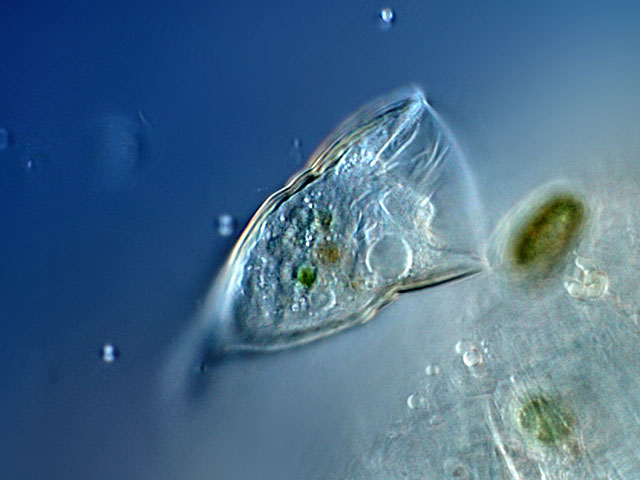 plingfactory: Leben im Teich:das Beringte Pokaltierchen (Cothurnia annulata (Ciliata)