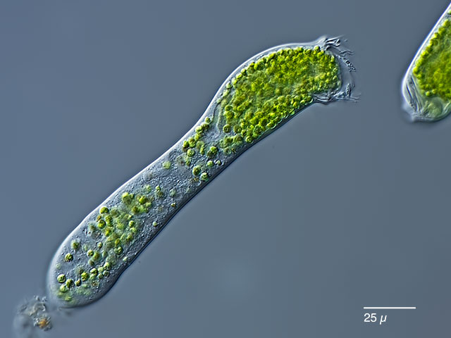 Freshwater and other micro-organisms from Germany: Ophrydium versatile ...