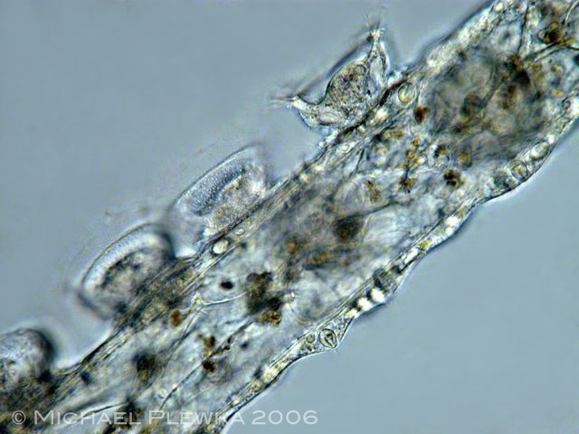 Limnic and other micro-organisms from Germany:Trichodina pediculus ...