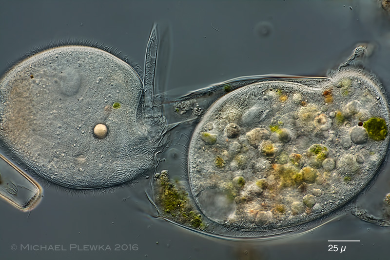 Freshwater and other micro-organisms from Germany: Holophrya teres ...