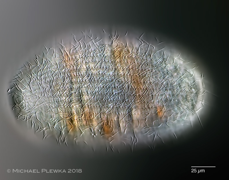 Freshwater and other micro-organisms from Germany: Holophrya teres ...