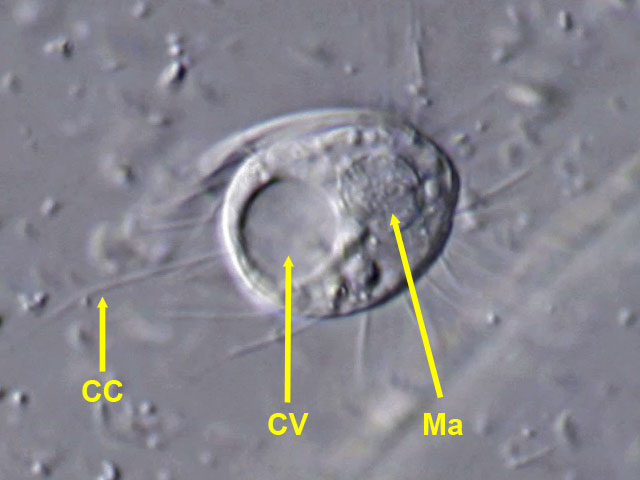 Freshwater and other micro-organisms from Germany: Urotricha farcta ...