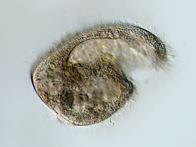 Leben im Teich:Beuteltierchen (Bursara truncatella) ( Ciliata)