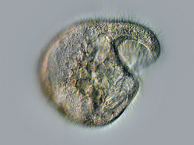 Leben im Teich:Beuteltierchen (Bursara truncatella) ( Ciliata)