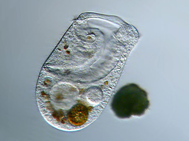 Leben im Teich:Pseudo-Beuteltierchen (Bursaridium pseudobursaria ...