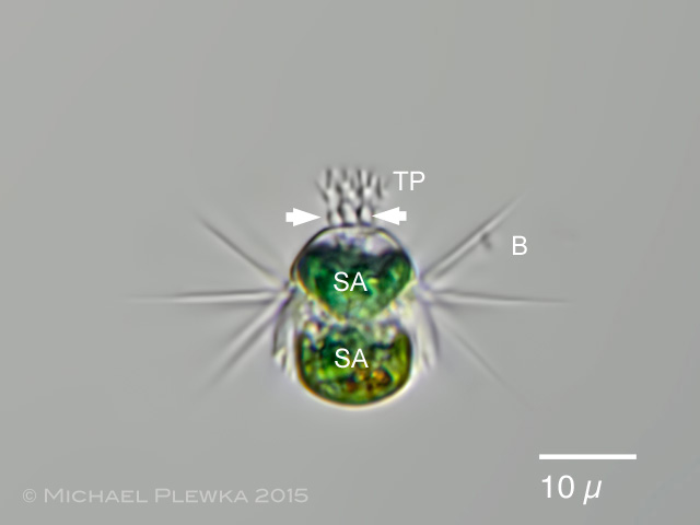 Freshwater and other micro-organisms from Germany: Myrionecta rubra ...