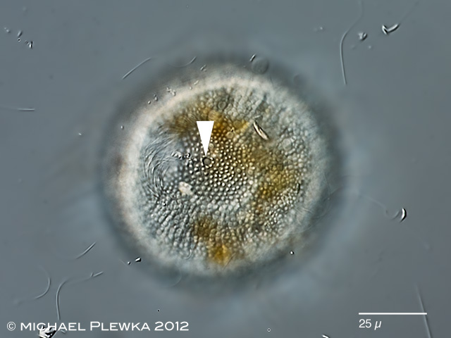 Leben im Teich: Cyclotrichium viride, (Gymnostomatea, Ciliata, Protista)