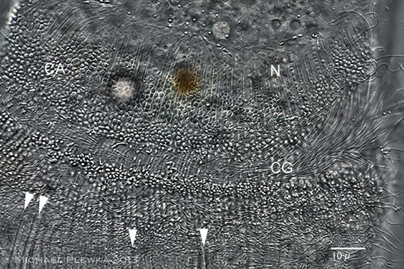 Leben im Teich: Cyclotrichium viride, (Gymnostomatea, Ciliata, Protista)