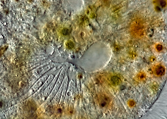 Leben im Teich: Cyclotrichium viride, (Gymnostomatea, Ciliata, Protista)