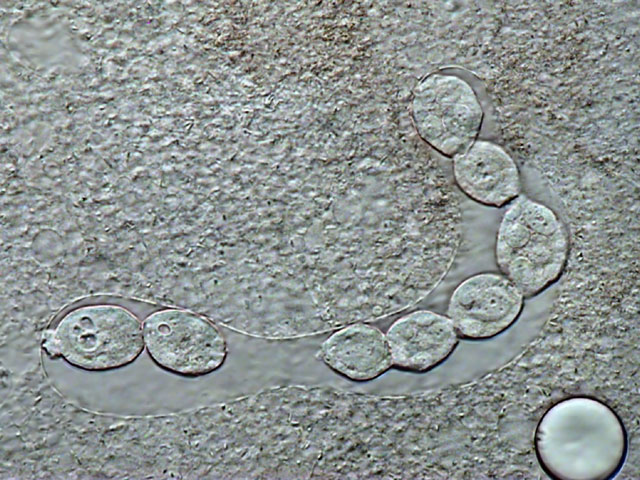 Freshwater and other micro-organisms from Germany: Paradileptus ...