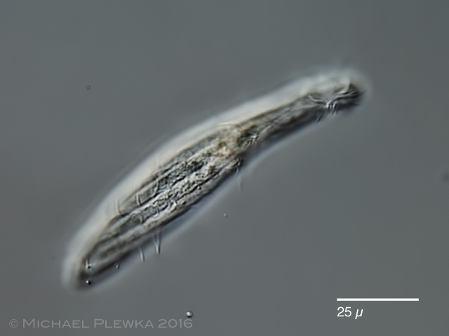 Freshwater and other micro-organisms from Germany: Lacrymaria salinarum ...