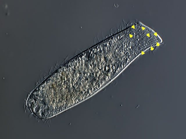 Freshwater and other micro-organisms from Germany: Spathidium cf ...