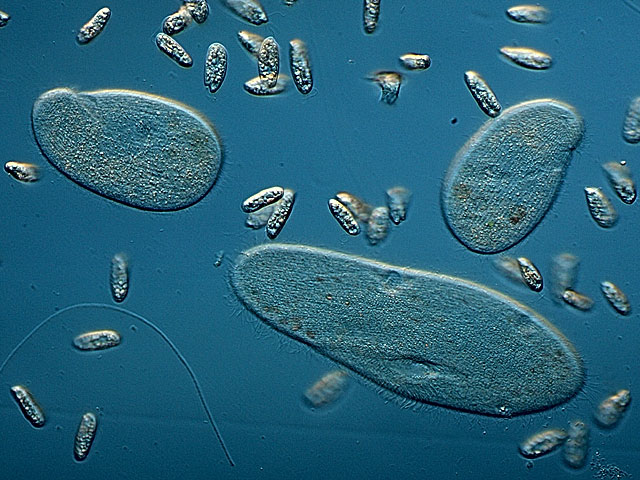 Stefansbachtal Gevelsberg: Leben im Teich: Einzeller (Protista ...