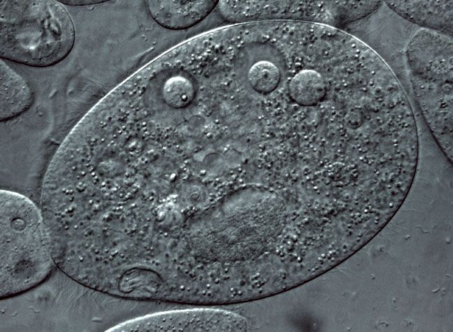 Stefansbachtal Gevelsberg: Leben im Teich: Einzeller (Protista ...