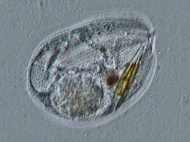 Leben im Teich: Schaufeltierchen (Lembadion bullinum) , Hymenostomata ...