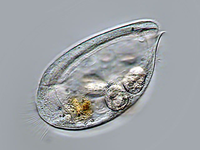 Leben im Teich: Schaufeltierchen (Lembadion bullinum) , Hymenostomata ...