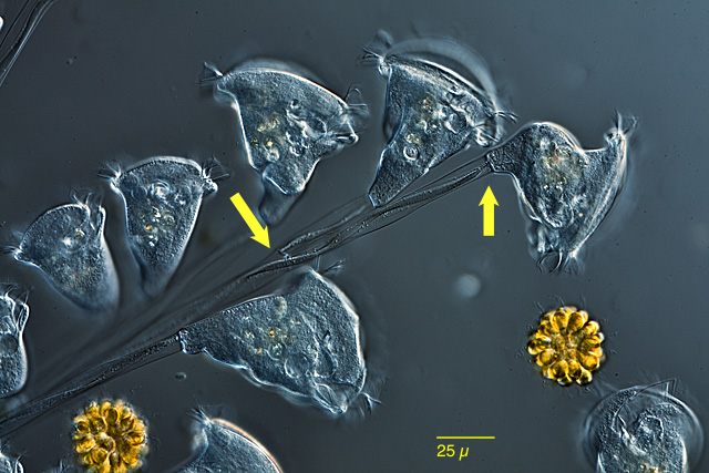 Leben im Teich: Carchesium polypinum, Peritricha, Ciliata, Protista