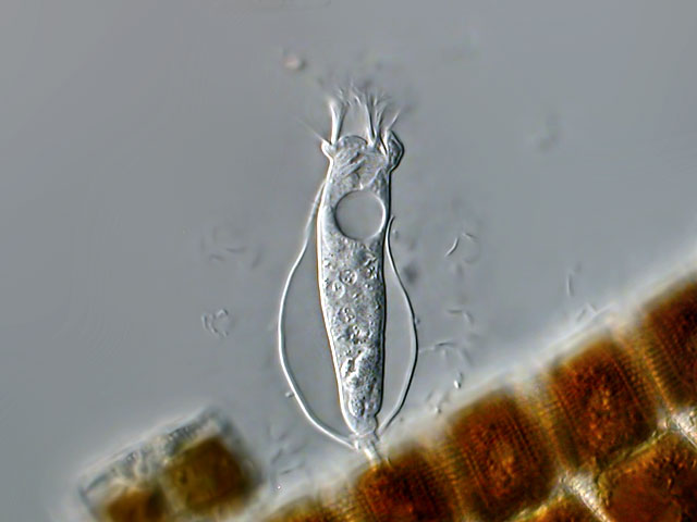plingfactory: Leben im Teich:das Beringte Pokaltierchen (Cothurnia annulata (Ciliata)
