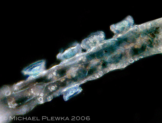 Limnic and other micro-organisms from Germany:Trichodina pediculus ...