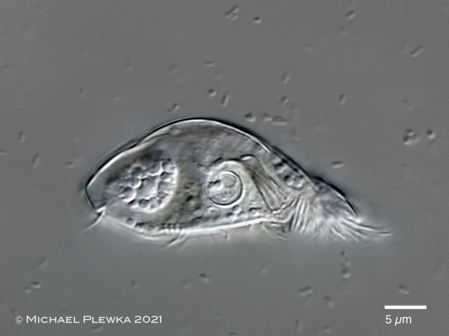 Freshwater and other micro-organisms from Germany: Chilodonella ...