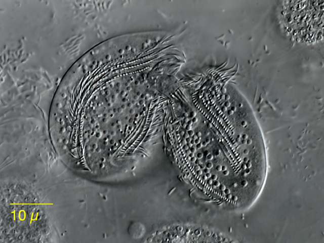 Leben im Teich: das Rädertier Teleskop-Rädertier Rotaria sp. (Rotatoria ...