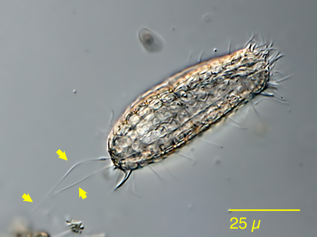 Leben im Teich und Garten: das Tonnentierchen (Coleps elongatus ...