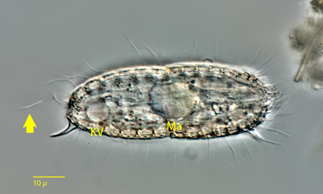 Leben im Teich und Garten: das Tonnentierchen (Coleps elongatus ...