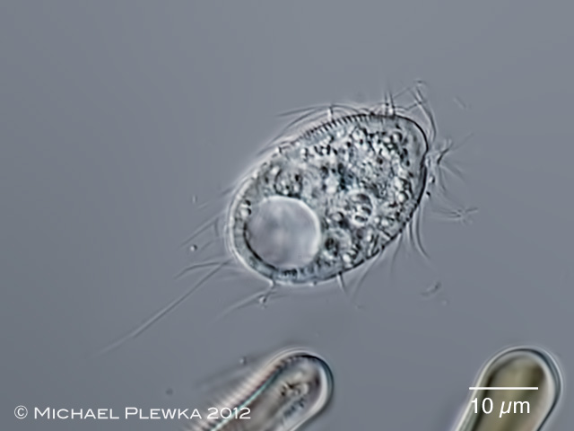 Freshwater and other micro-organisms from Germany: Urotricha farcta ...