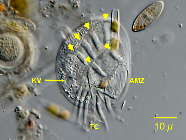 Freshwater and other micro-organisms from Germany: Blepharisma musculus ...
