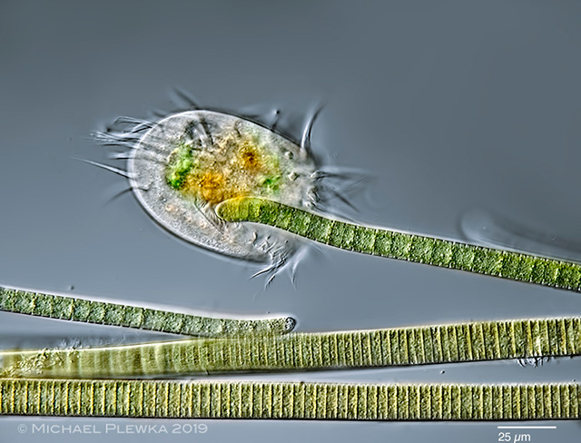 Freshwater and other micro-organisms from Germany: Euplotes sp.)