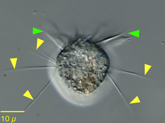 Leben im Teich: Springtierchen (Halteria sp.) (Oligotrichida, Ciliata ...
