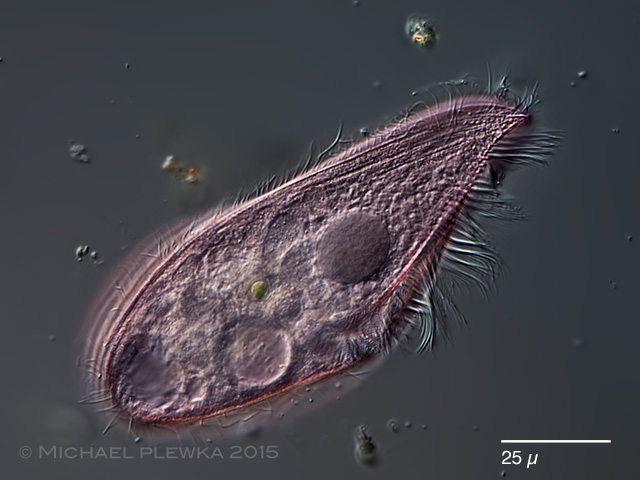 Freshwater and other micro-organisms from Germany: Blepharisma ...