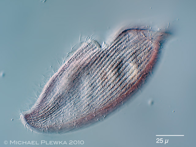 Freshwater and other micro-organisms from Germany: Blepharisma musculus ...