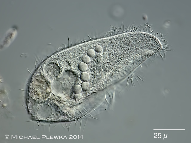 Freshwater and other micro-organisms from Germany: Blepharisma musculus ...