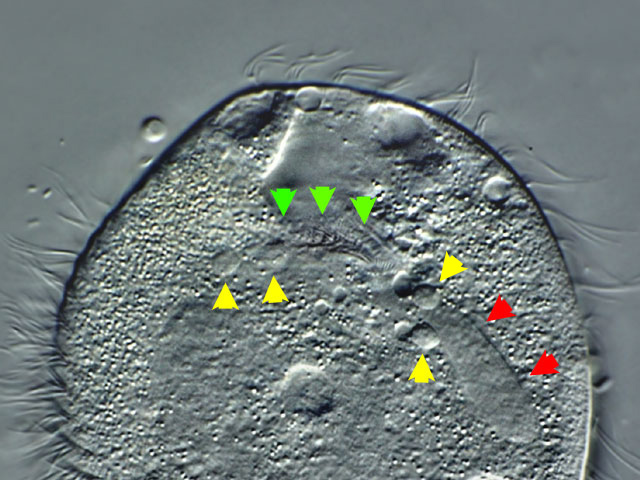 Leben im Teich: Phacodinium metchnikoffi, Ciliata