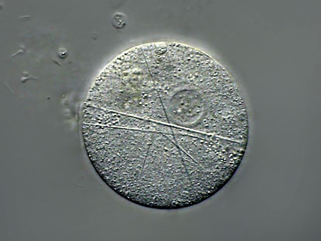 Leben im Teich: Phacodinium metchnikoffi, Ciliata