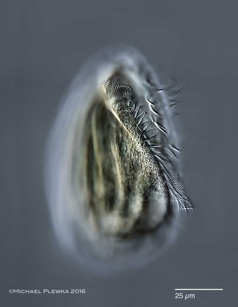 Freshwater and other micro-organisms from Germany: Phacodinium metchnikoffi, Ciliata