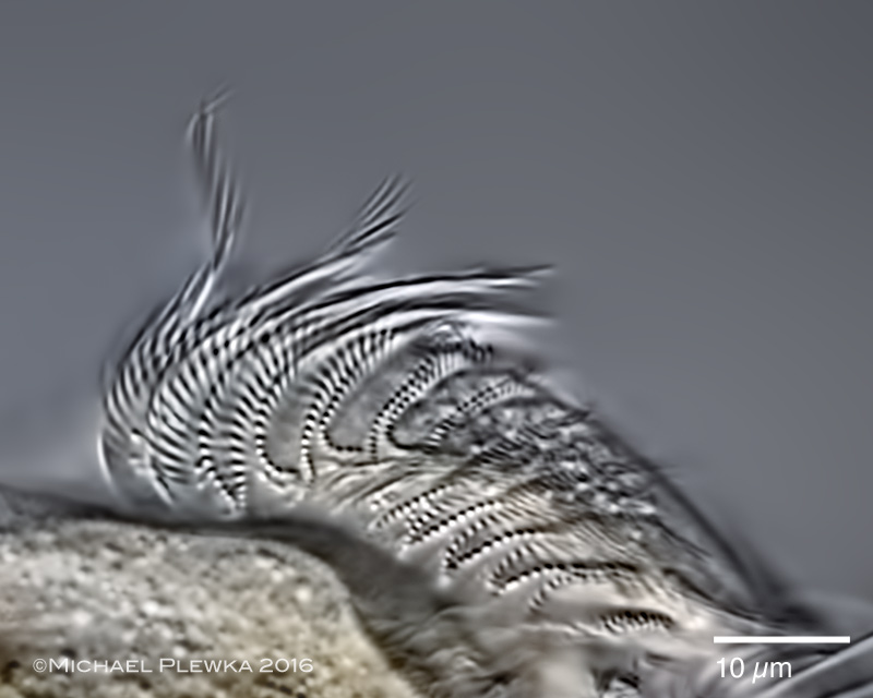 Freshwater and other micro-organisms from Germany: Phacodinium metchnikoffi, Ciliata