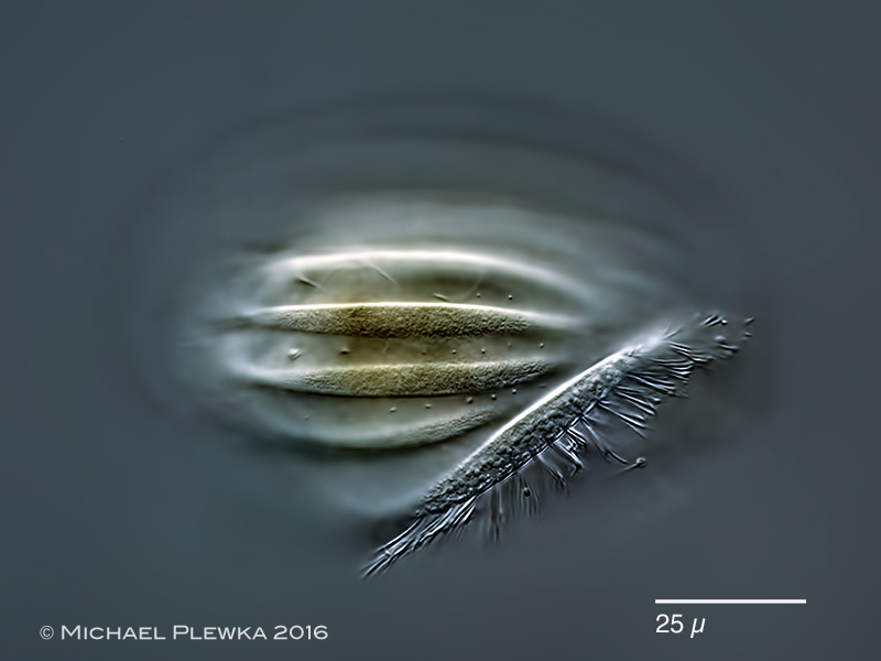 Freshwater and other micro-organisms from Germany: Phacodinium metchnikoffi, Ciliata