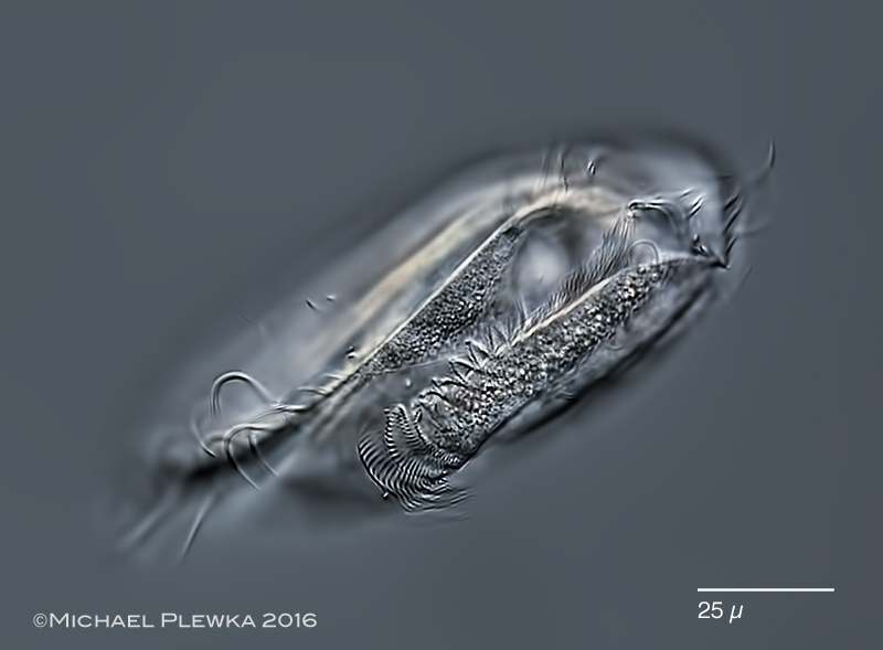 Freshwater and other micro-organisms from Germany: Phacodinium metchnikoffi, Ciliata