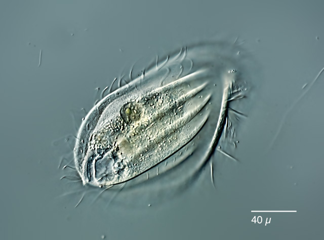 Leben im Teich: Phacodinium metchnikoffi, Ciliata