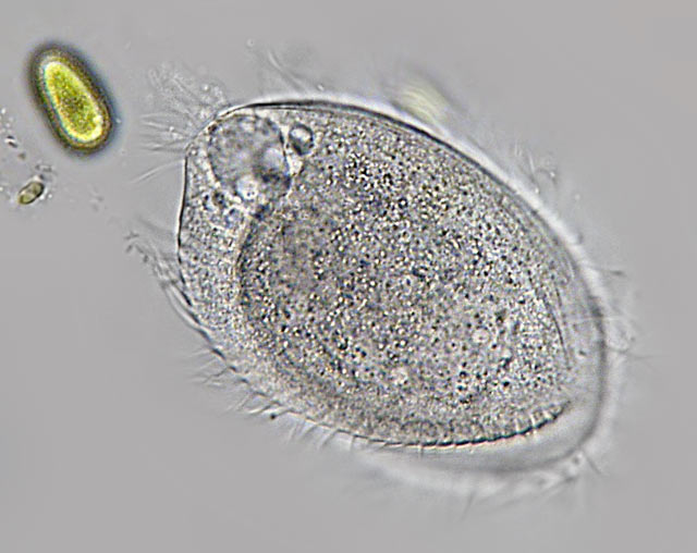 Leben im Teich: Phacodinium metchnikoffi, Ciliata